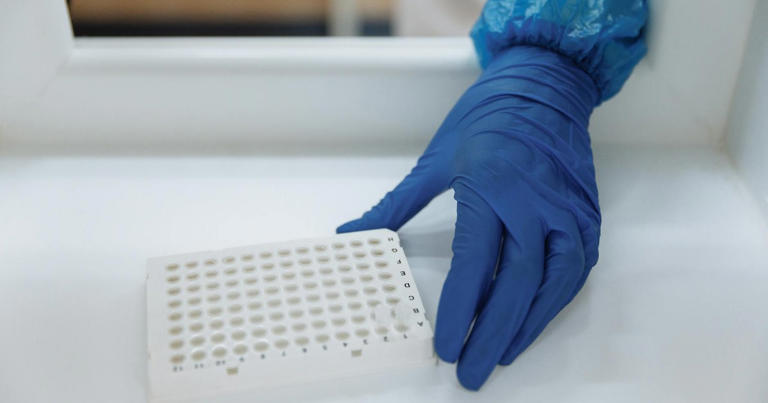 Scientists charged with smuggling deactivated Mpox virus into US