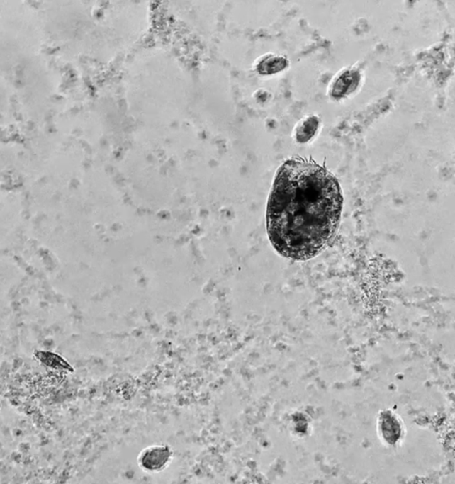 Newly discovered microbe turns into a cannibalistic 'supergiant'