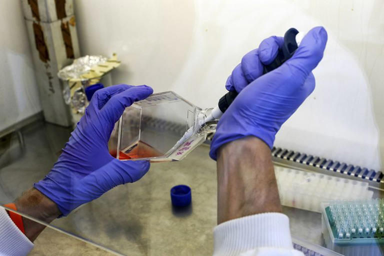 CAR-T therapy brings hope to kidney patients with few transplant options