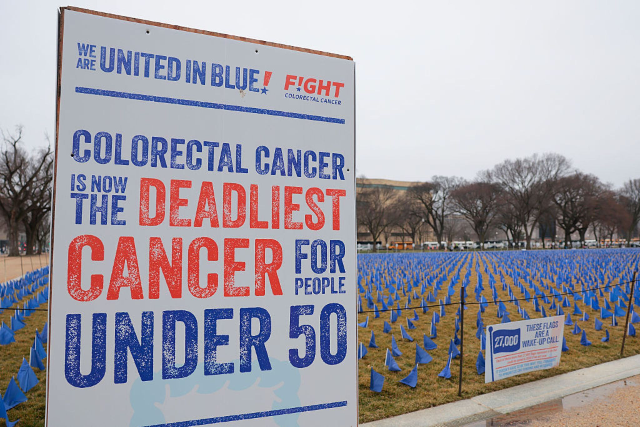 New colorectal cancer breakthrough could eradicate tumors without surgery