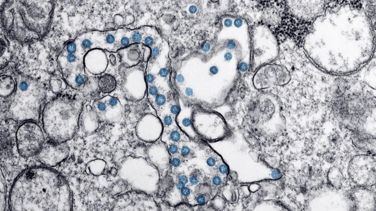 Cells that double their DNA through failed division survive far better ...