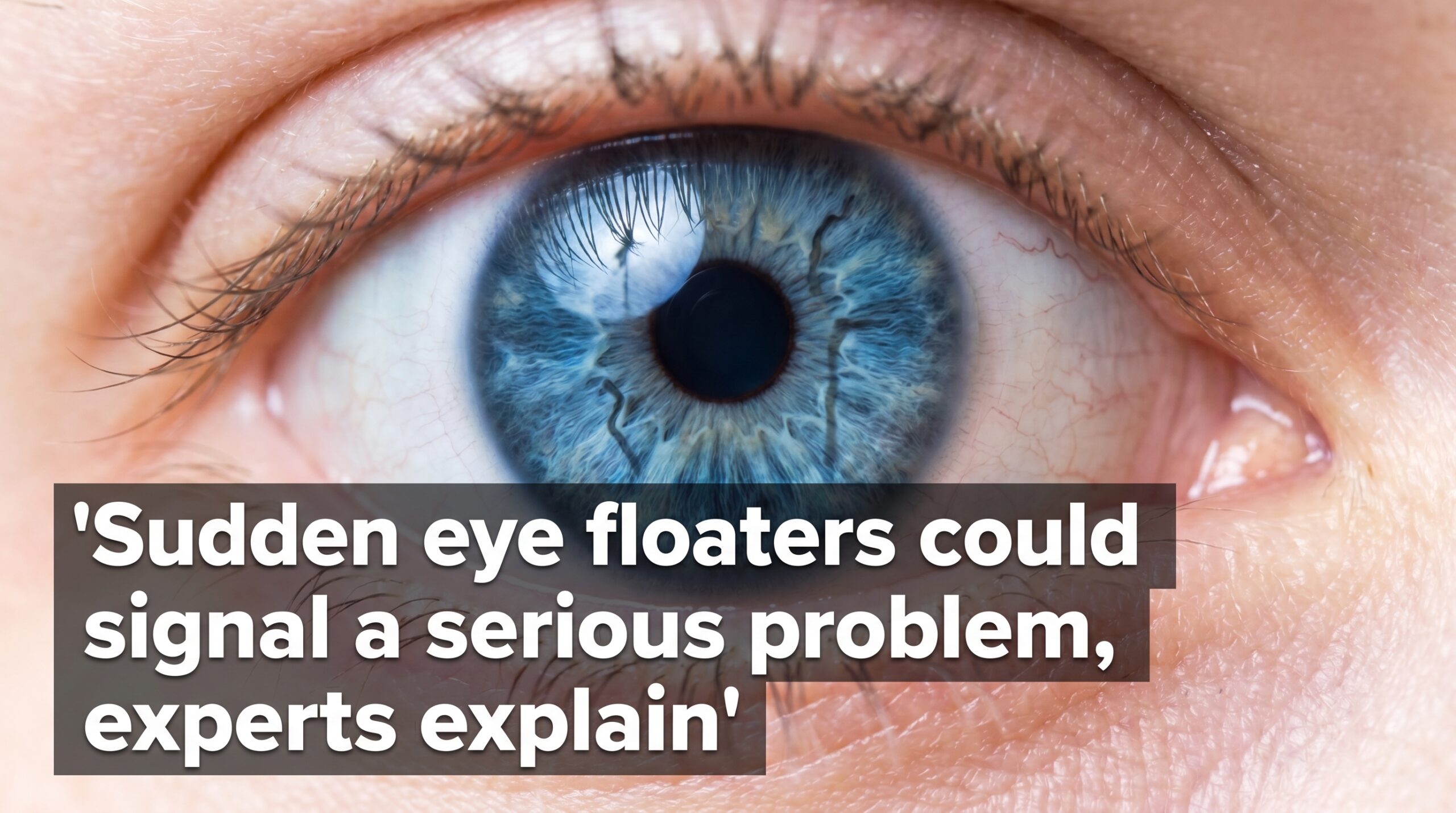 Sudden eye floaters could signal a serious problem, experts explain