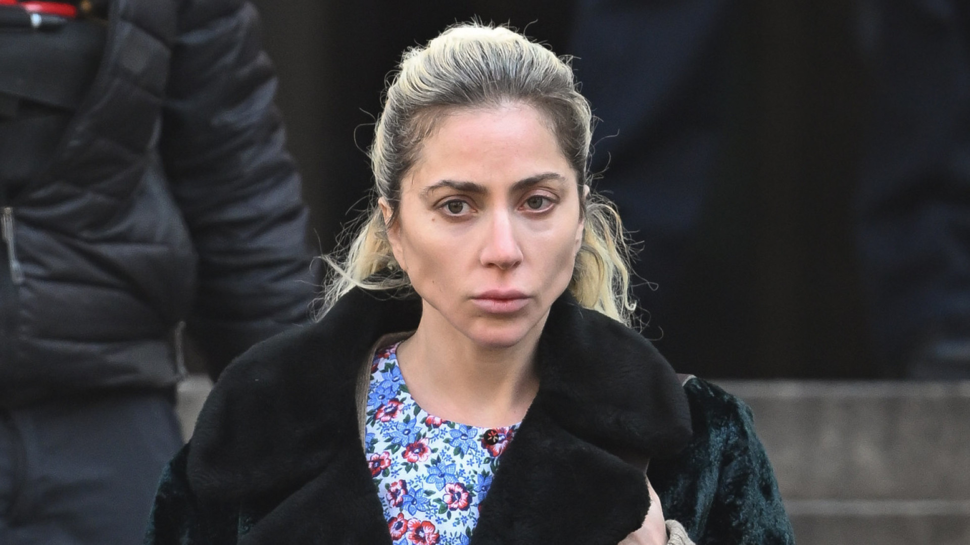 Lupus: Understand the mysterious disease affecting several celebrities
