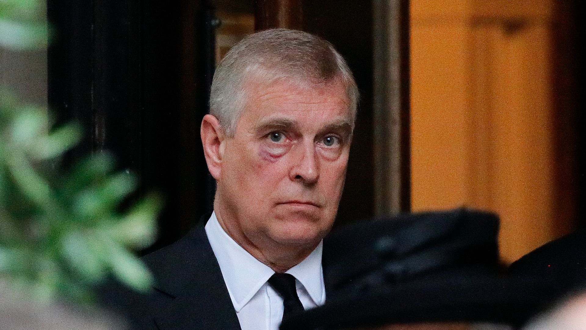 The real reason Prince Andrew was spotted with a large bruise on his ...