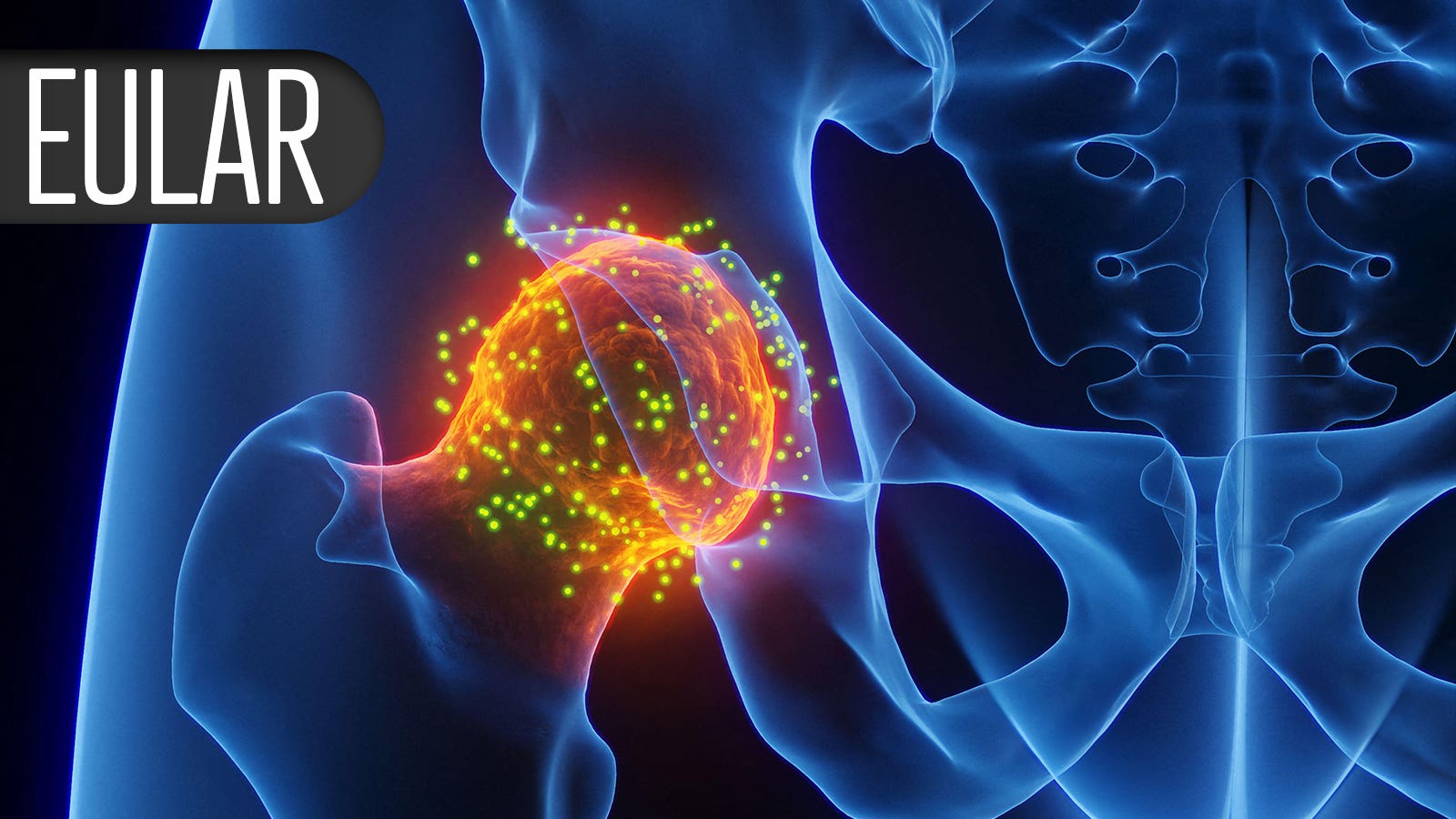 How much prednisone is too much in treating rheum effects from cancer ...