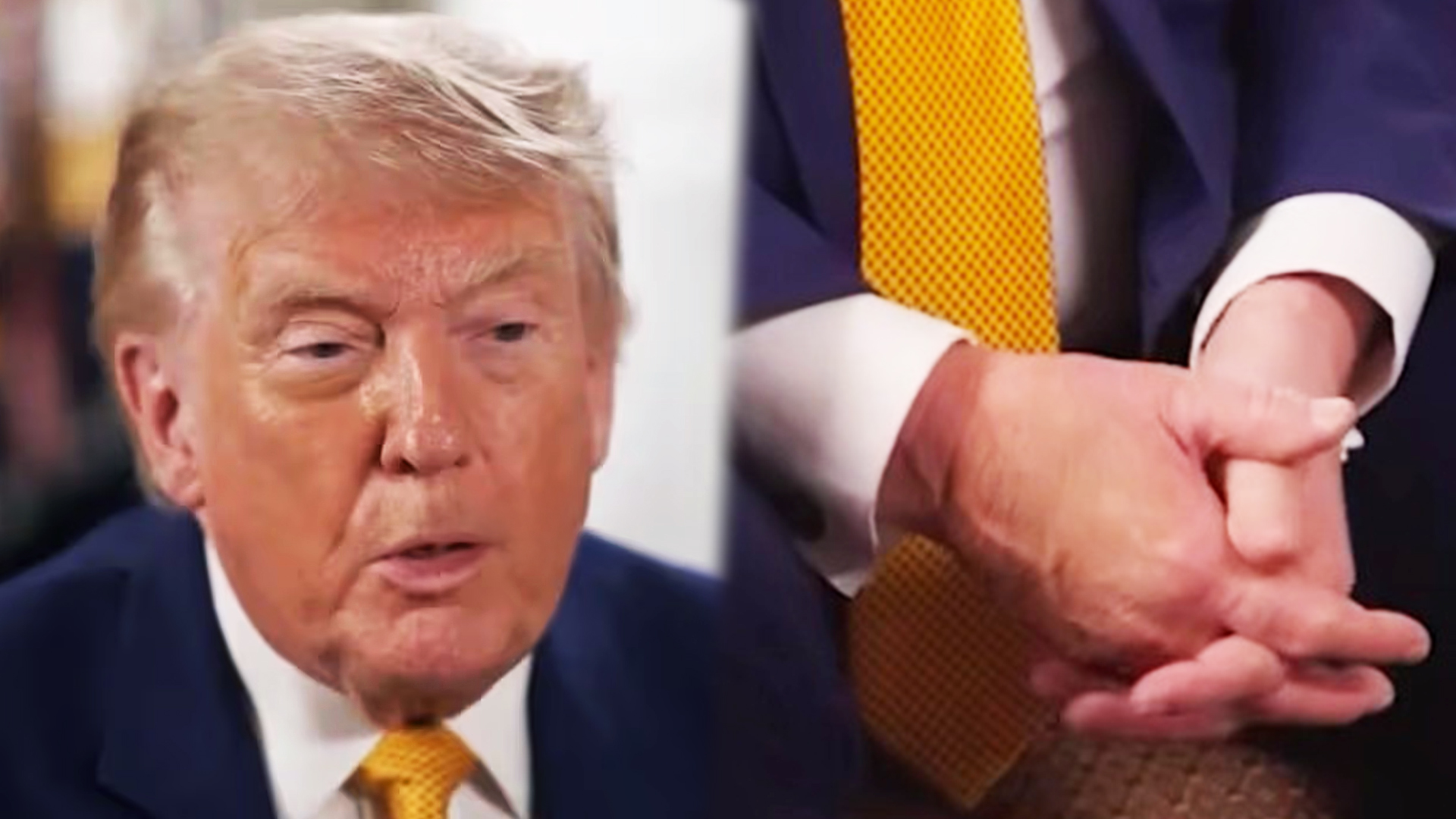 Concerns about Trump's eye and hand