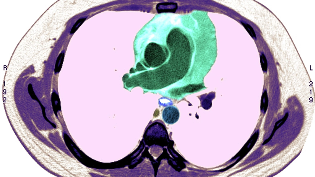 How medical imaging is changing diagnoses