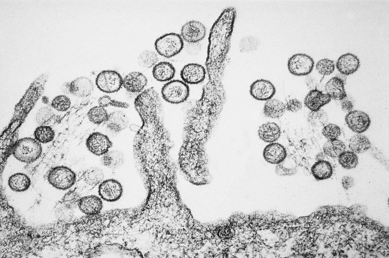 New hantavirus sequencing tool maps whole genomes from hard-to-test samples