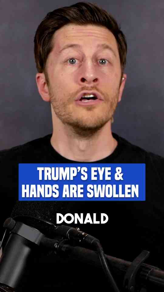 What's going on with Trump's eye? #shorts