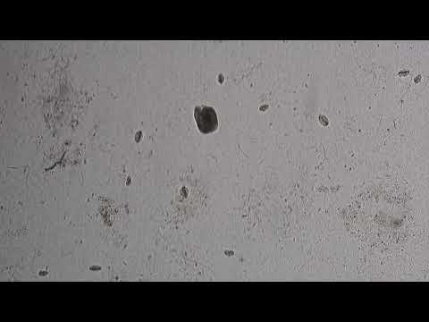 Newly discovered microbe turns into a cannibalistic 'supergiant'