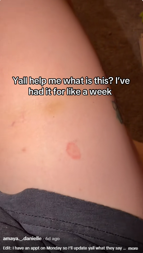 Woman thought it was just allergies—until doctor’s shocking diagnosis