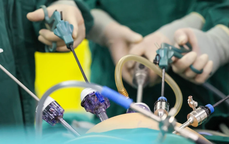 Study links major surgery in seniors to lasting memory loss