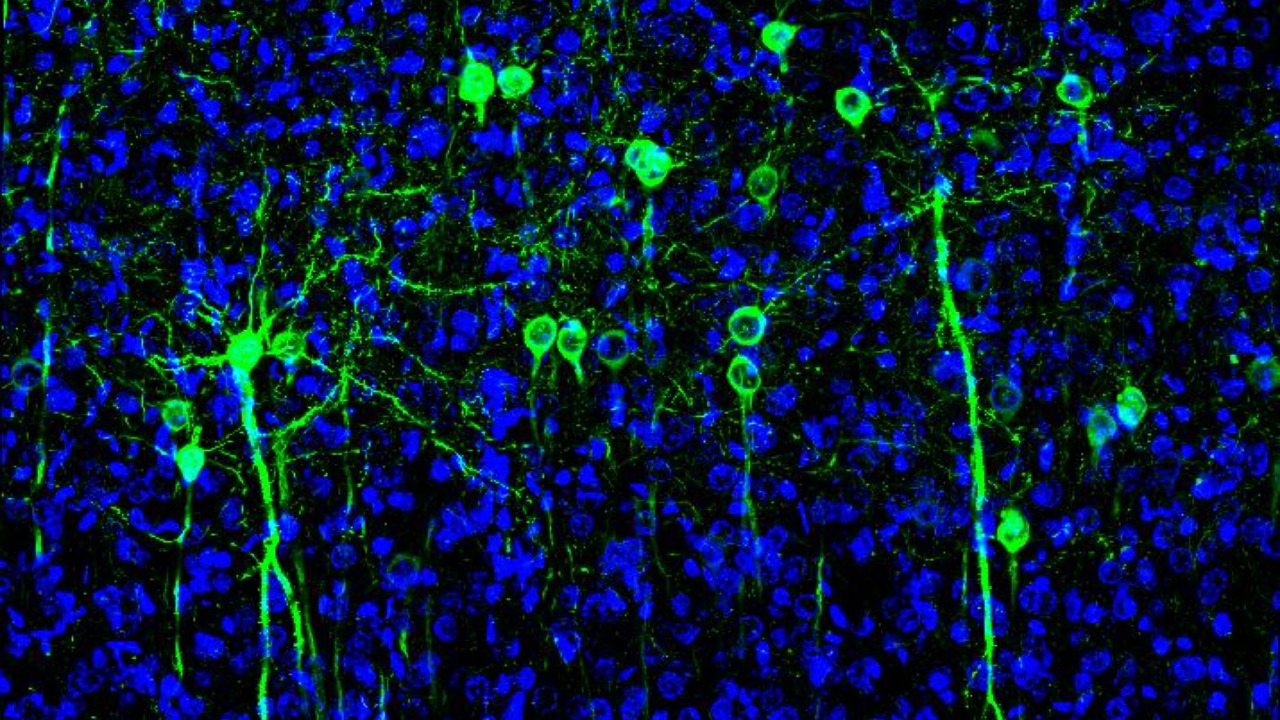 Scientists erased anxiety in mice by tuning a single gene in one ...