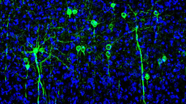 Scientists erased anxiety in mice by tuning a single gene in one ...
