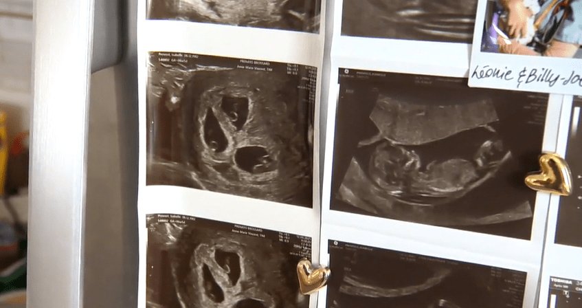 Quebec single mother welcomes triplets after years of fertility struggles