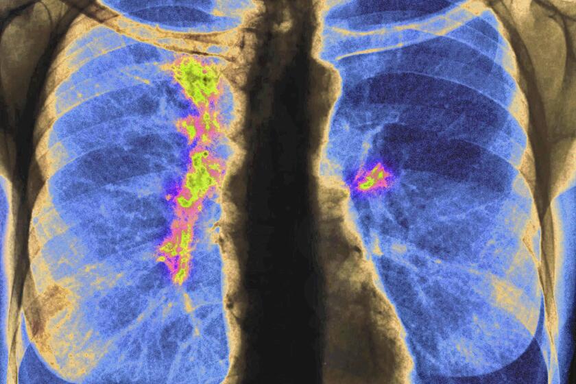 One label, many risks: how grouping Asian Americans hides deadly cancer ...