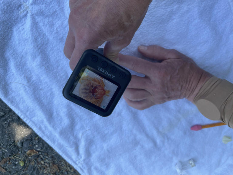 How to identify lone star ticks, which can cause a dangerous red meat ...