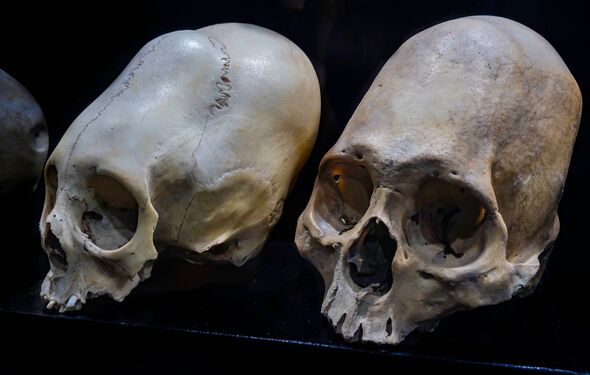 'Conehead humans' could be aliens as DNA tests leave scientists baffled