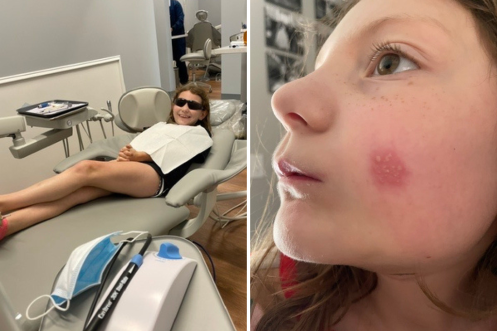 My daughter said her teeth felt strange. Then surgeons removed her jawbone