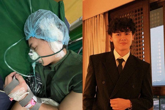 Ex-PBB housemate Josh Ford undergoes five surgeries