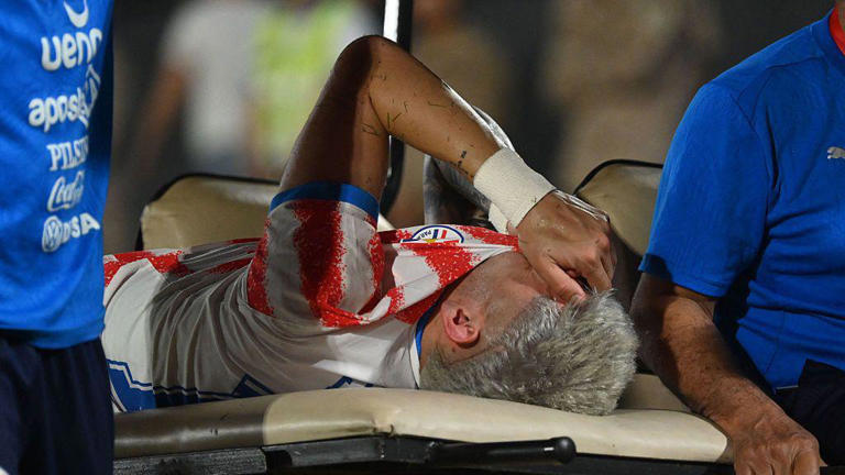 Paraguay star Enciso injured in World Cup warm-up