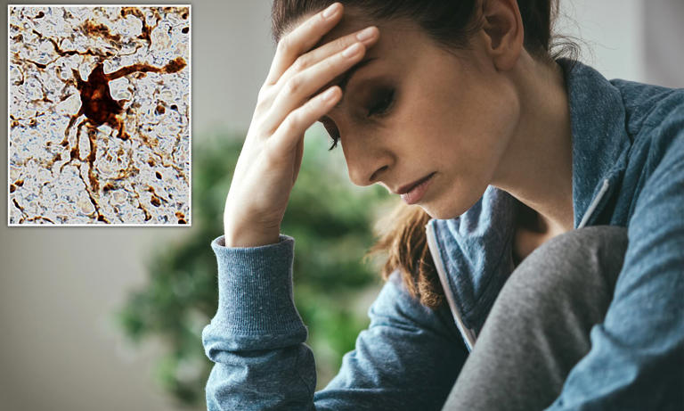 How 'zombie cells' could be quietly taking over your body, driving a ...