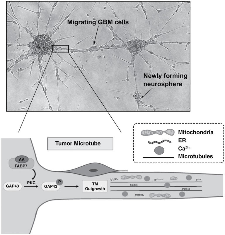 Researchers discover way to inhibit brain cancer's infiltration ...