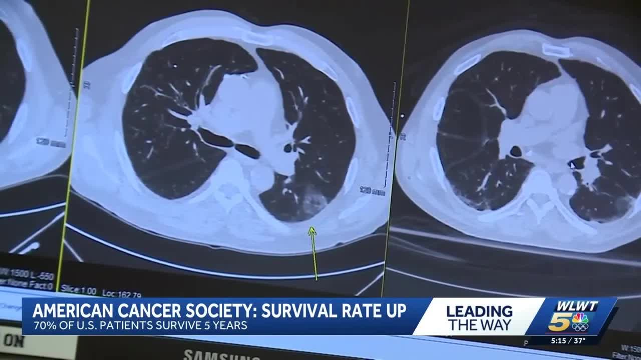 Cancer survival rates reach new milestone in the US