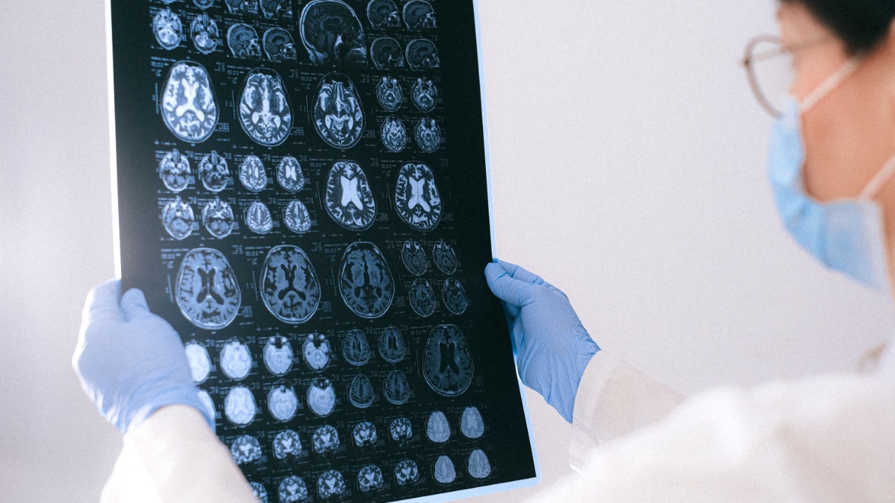 The autism study leaned on 20 mouse models, brain scans from 940 young ...