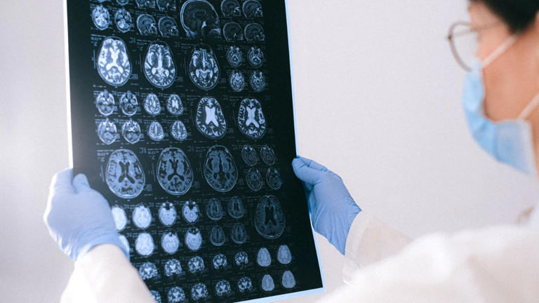 The autism study leaned on 20 mouse models, brain scans from 940 young ...