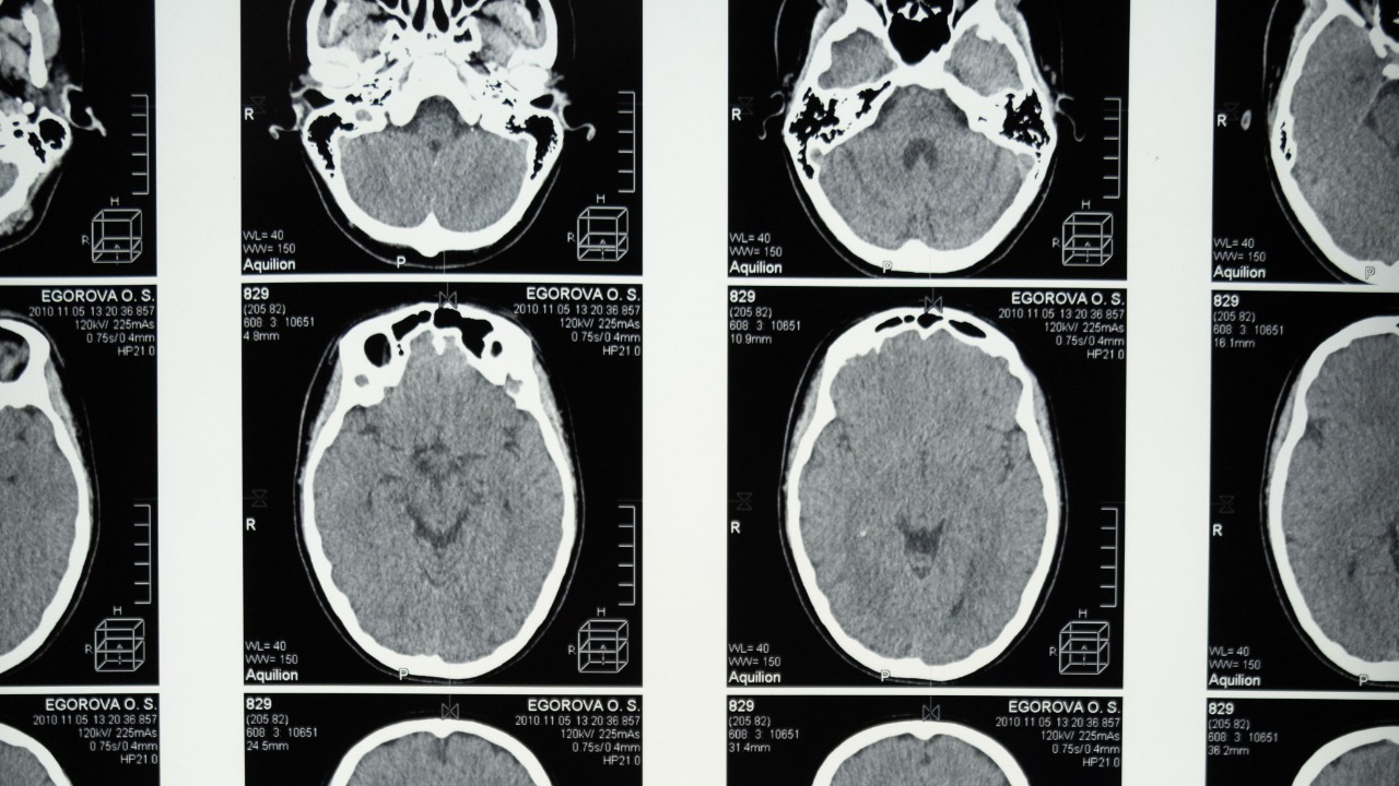 Your brain’s decision-making cortex finishes wiring only in your mid ...