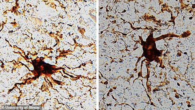 How 'zombie cells' could be quietly taking over your body, driving a ...