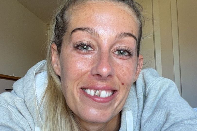 Bride loses front tooth days before wedding after pizza order mistake