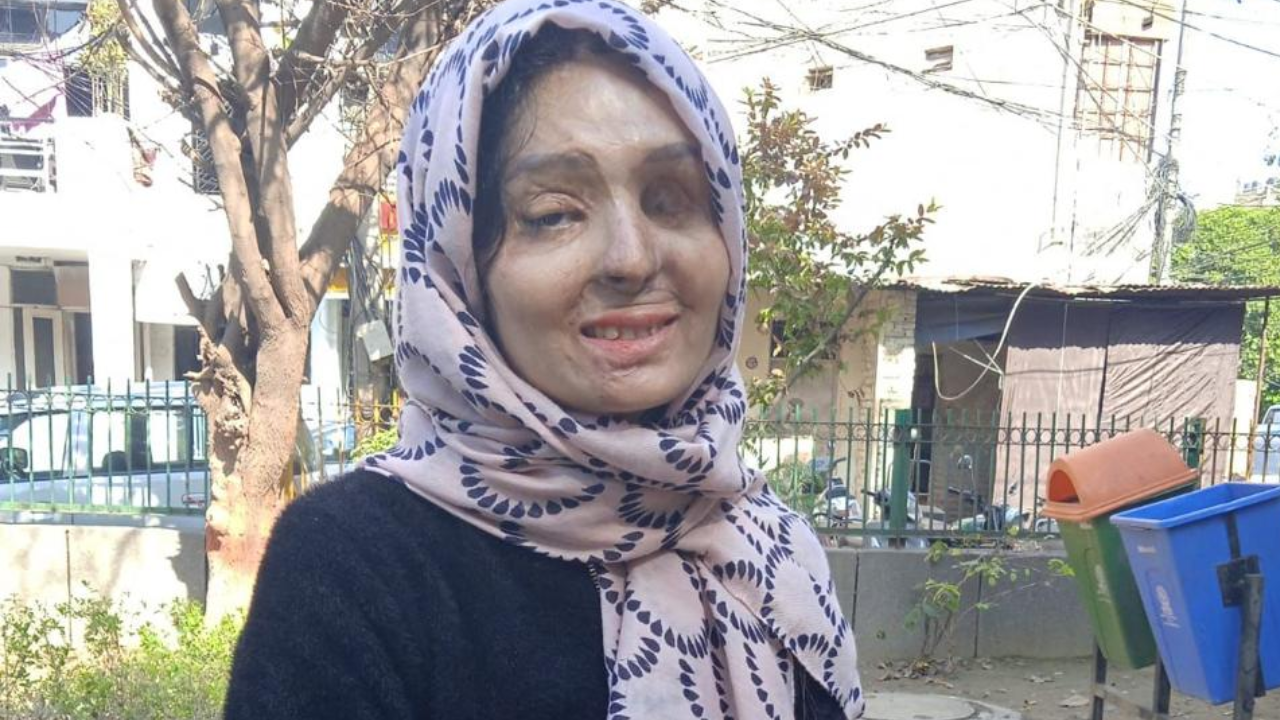 3 years on, acid attack survivor wins right to disability review