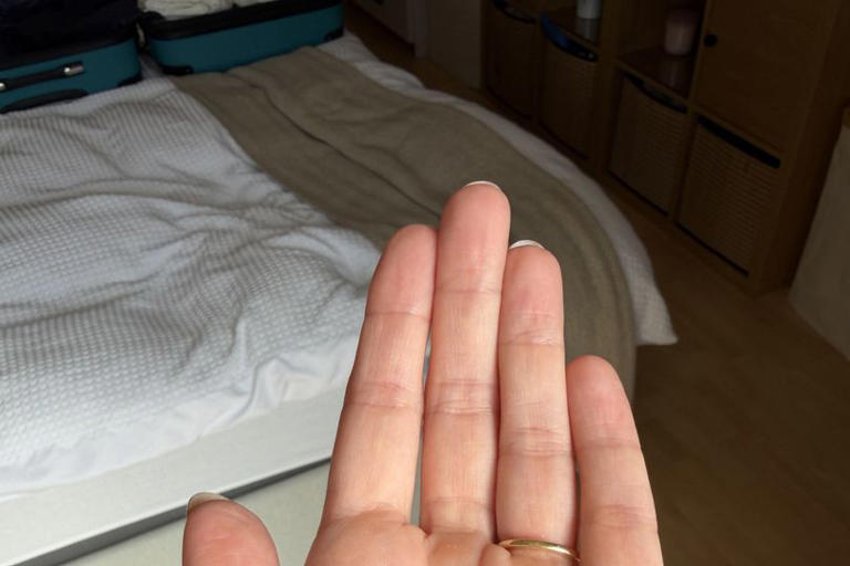 Bride loses front tooth days before wedding after pizza order mistake