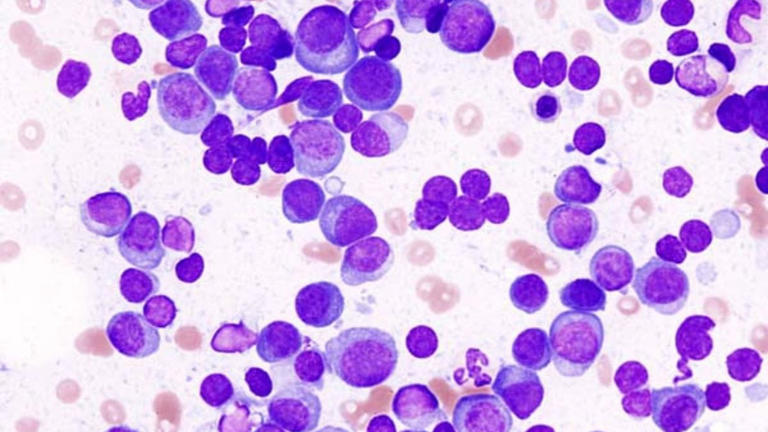 Scientists have found a better way to deliver cancer drugs—deeper in ...