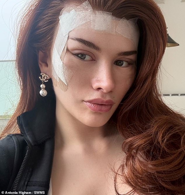 Woman, 28, spends £9,000 on facelift she didn't need to get Bella Hadid ...
