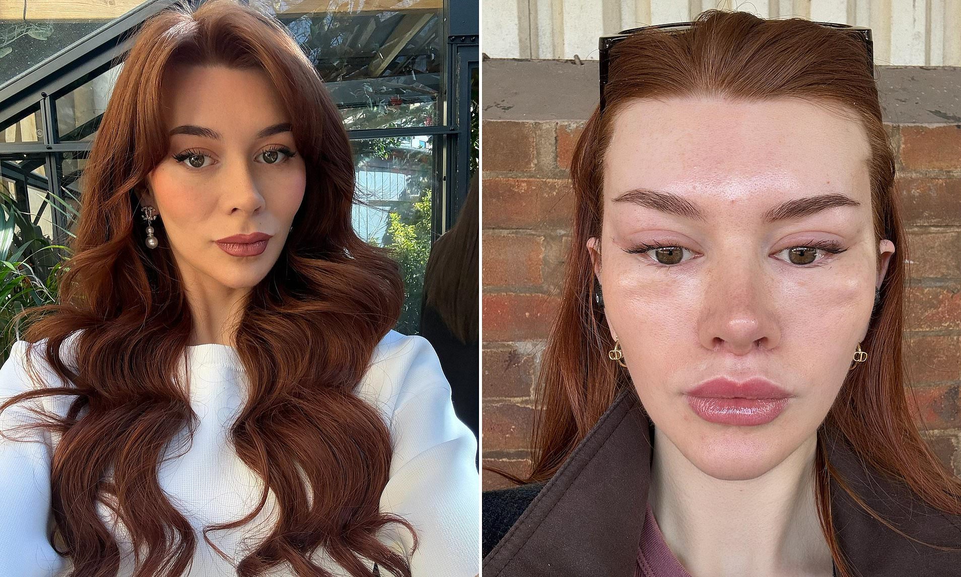 Woman, 28, spends £9,000 on facelift she didn't need to get Bella Hadid ...