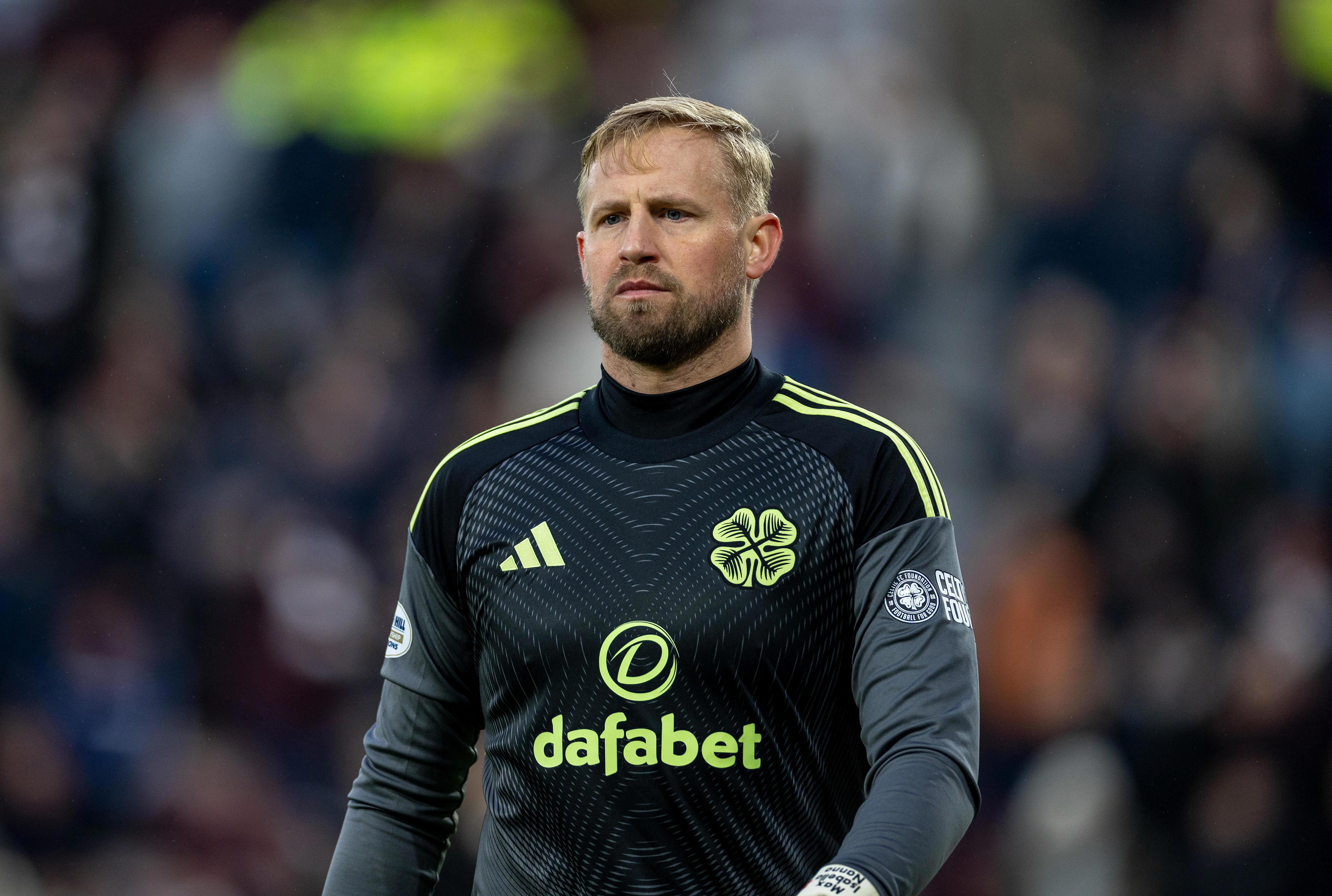 Schmeichel zet punt achter carrière na zware schouderblessure