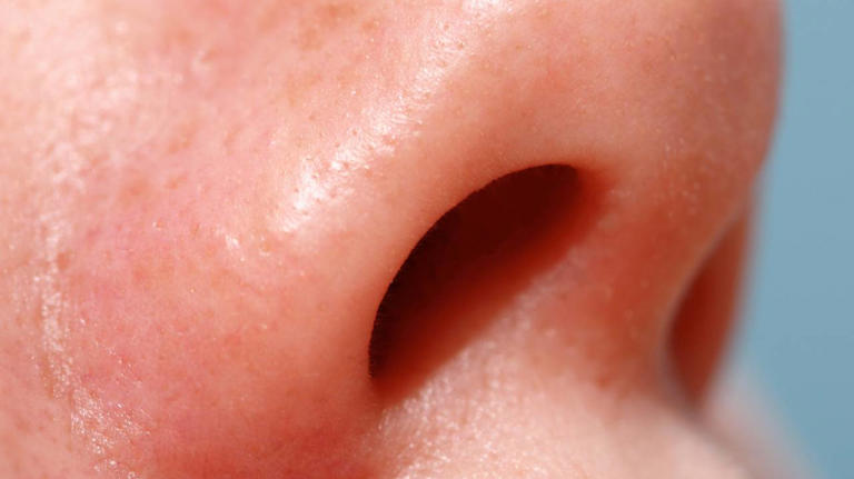 Nose surgeon explains key signs of 'cocaine nose' and how to fix it