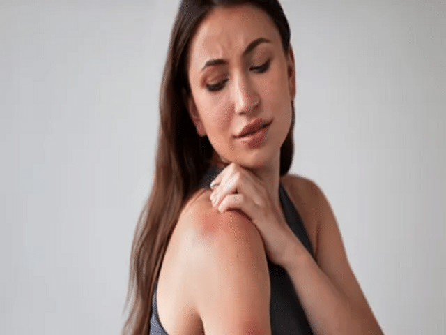Why do body rashes and acne start appearing in the summer? A skin ...
