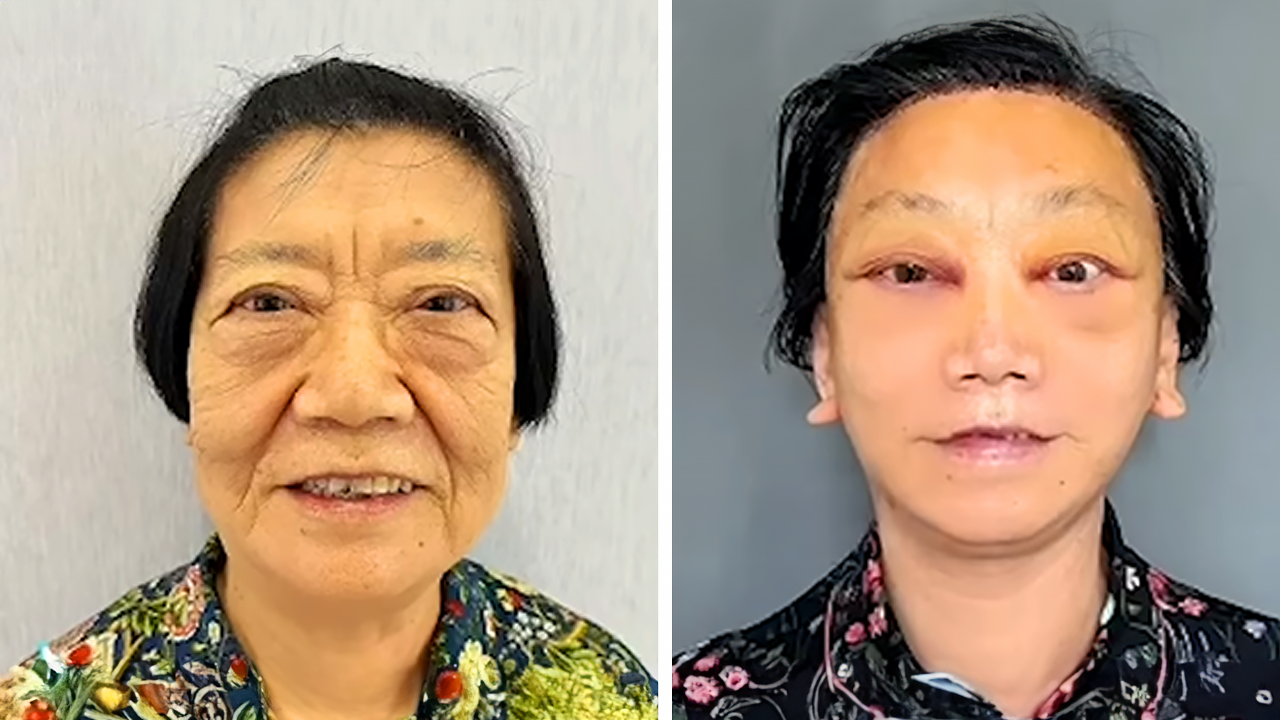 Plastic surgeon reacts to extreme surgery trends online