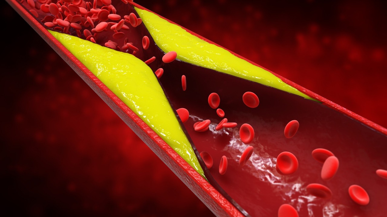 A single-shot gene-silencing therapy just cut dangerous cholesterol in ...
