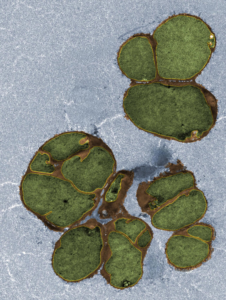 Mysterious acids keep bacteria rod-shaped by restraining rogue enzyme ...