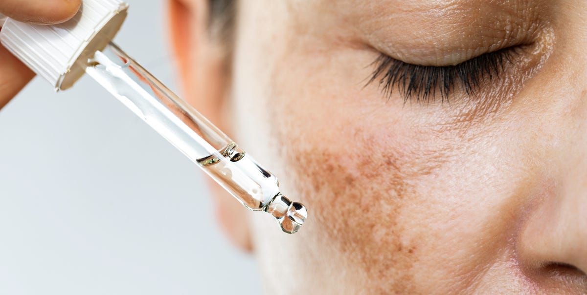 This one habit is the best way to treat melasma at home, according to ...