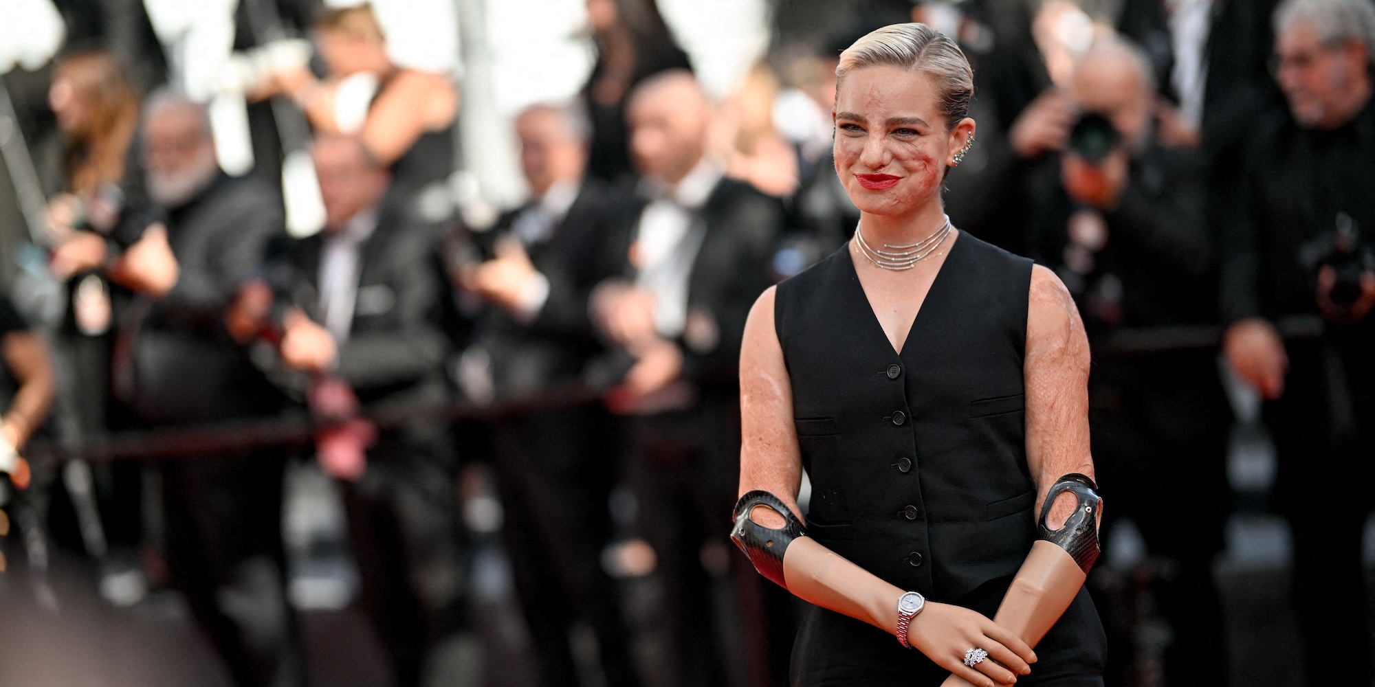 « On peut rire du handicap » : notre interview avec Bebe Vio