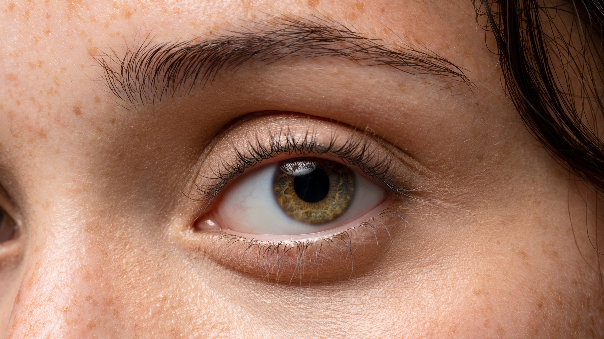 No needles required: A new eye-scanning tool flags anemia risks in seconds