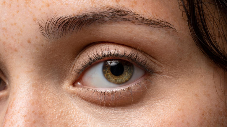 No needles required: A new eye-scanning tool flags anemia risks in seconds
