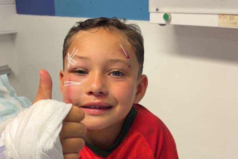 Mum hits out after four-year-old injured in e-scooter collision