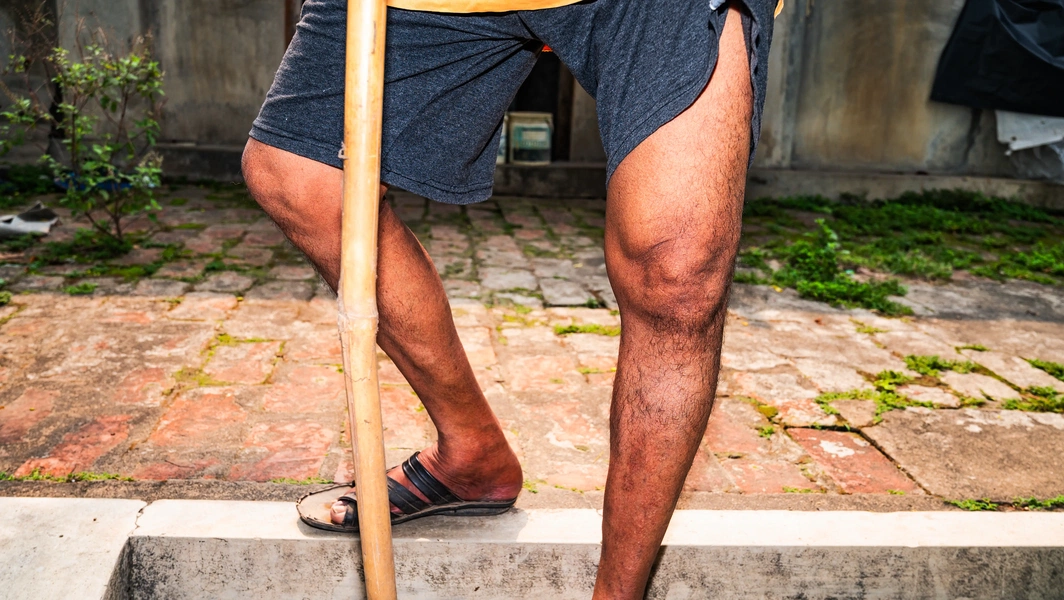 Supplements that keep your joints happy